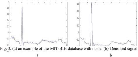 Figure 1 From Ecg Signal Classification Using Svm With Multi Feature Semantic Scholar