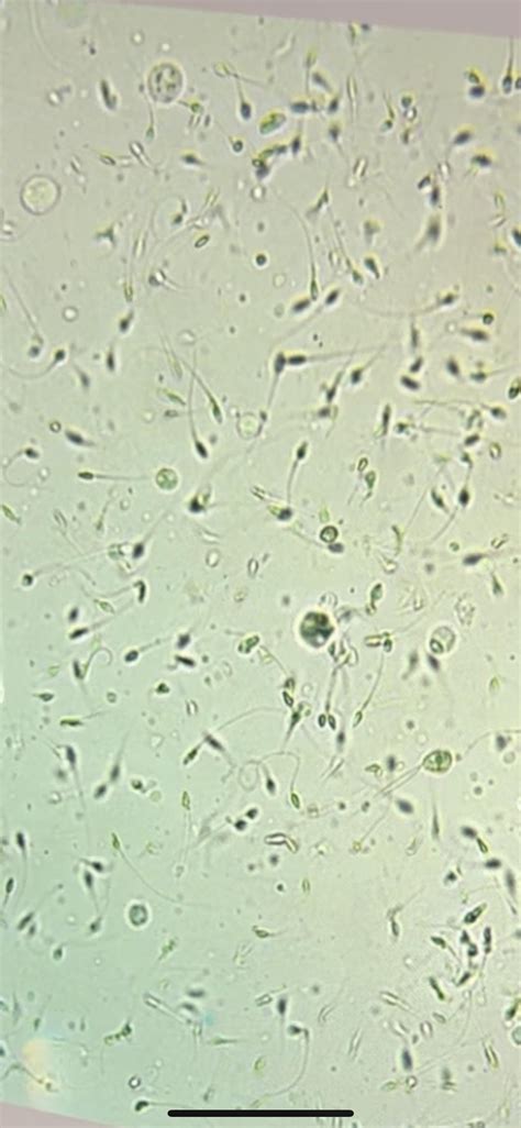 Microscope Pics Pretty Neat R Maleinfertility