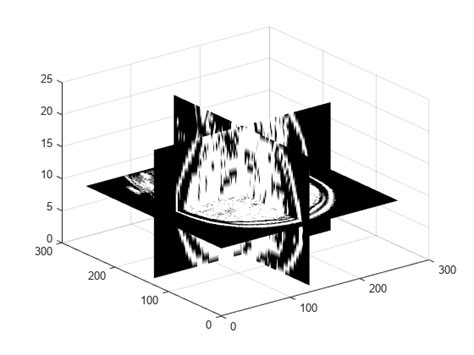 Imbinarize Binarizar Una Imagen 2d En Escala De Grises O Un Volumen 3d Por Medio Del Método