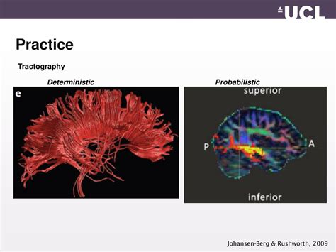 Ppt Diffusion Tensor Imaging Powerpoint Presentation Free Download Id 1534653