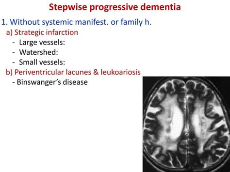 Algorithm For Dementia For Postgraduates Ppt