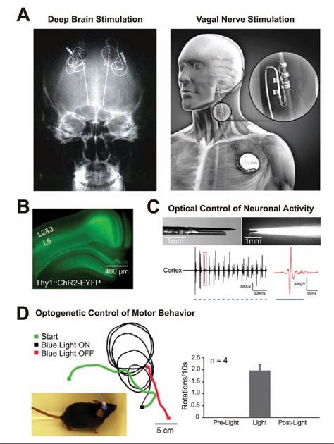 Figure 1 From Noninvasive Neuromodulation With Ultrasound A Continuum Mechanics Hypothesis
