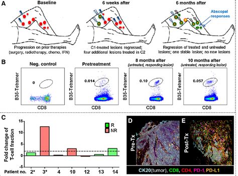 Figure From Intratumoral Delivery Of Plasmid IL Via Electroporation Leads To Intratumoral