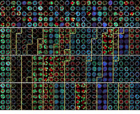 Figure 6 From Correlation Clustering Of Organoid Images Semantic Scholar