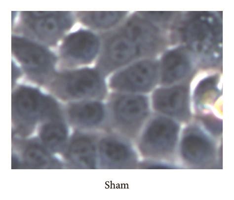 Ginsenoside Rg1 Protected Hbe Cells Against Cse Or Tgf β1 Induced Emt