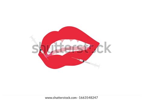 Lips Filler Injections Sensual Lips Syringes Stock Vector Royalty Free