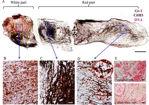Neutrophil Extracellular Traps Promote Deep Vein Thrombosis In Mice Pmc
