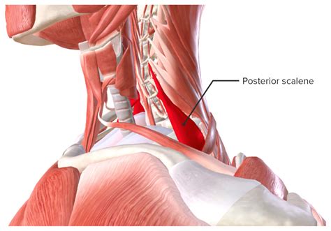 Anterior Scalene Cat