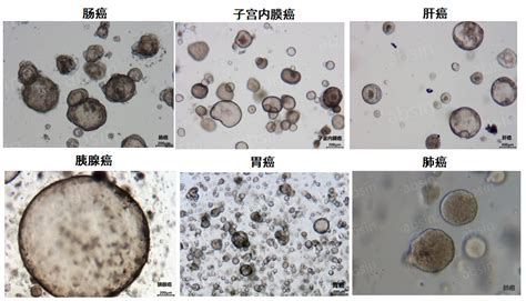 如何用类器官技术解决药物筛选问题？ 爱必信（上海）生物科技有限公司
