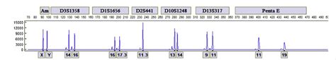 Str Analysis Explained — Ande® Str Analysis Explained — Ande®