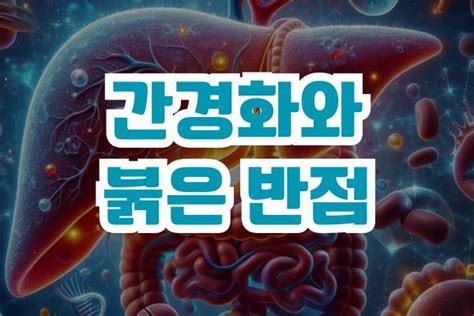 간 건강의 적신호 간경화 붉은 반점 총정리