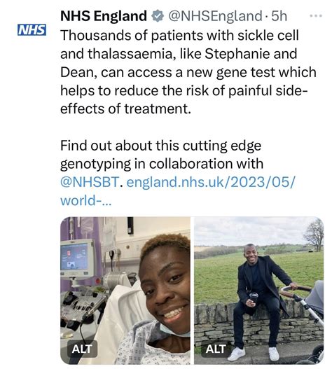 Sickle Cell Society On Linkedin Today Nhs England Announced That