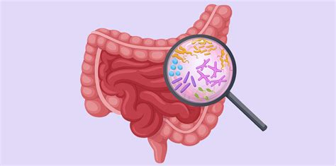 Bacterial Gastroenteritis Causes Symptoms Treatment Health Normal
