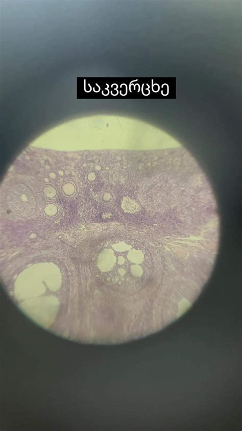 საკვერცხე მიკროსკოპში 👇 🤔🙂 ყველაფერი მედიცინაზე