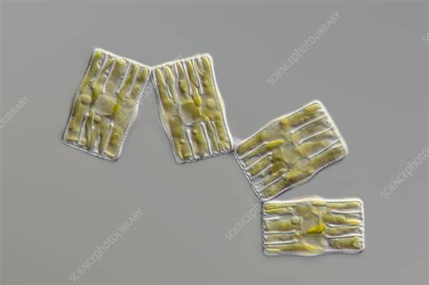 Tabellaria Sp Algae Light Micrograph Stock Image C057 7496 Science Photo Library