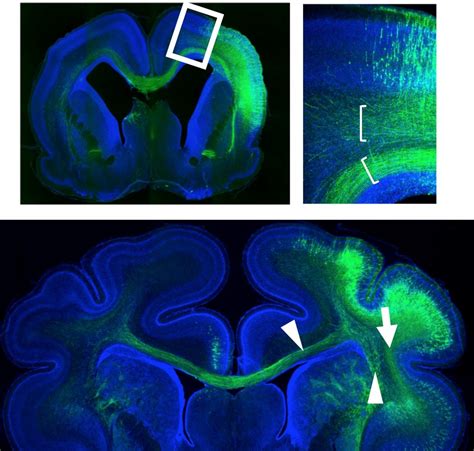 Map Of Neuronal Pathways Of The Mammalian Cerebral Cortex And Their