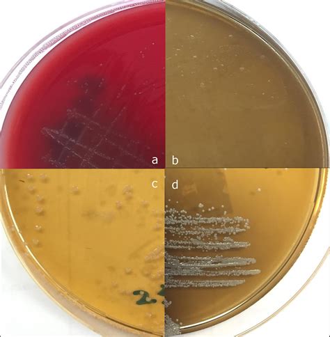 Novel Selective Medium For The Isolation Of Corynebacterium