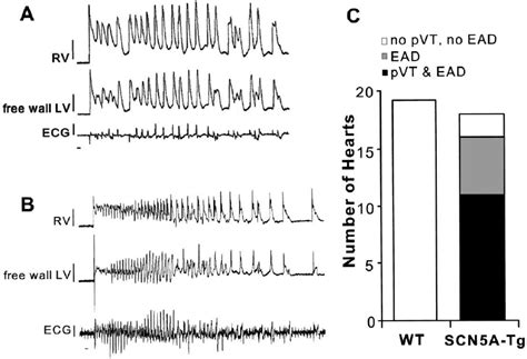 Repetitive Ventricular Ectopy And Polymorphic Ventricular Tachycardias