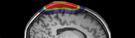 Program Diffuse Optical Imaging Workshop University Of Illinois At Urbana Champaign