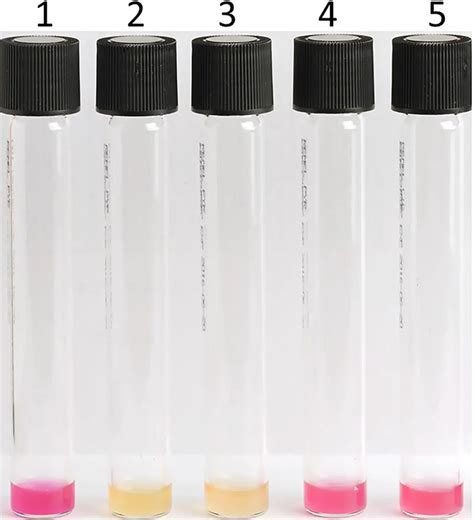 Pyr Test Principle Procedure Results • Microbe Online