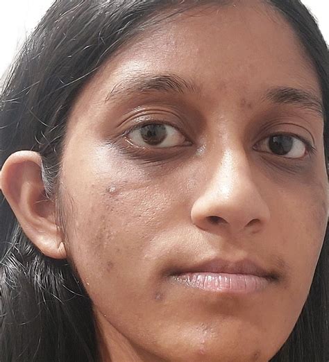 Intelligentsystemsdesign Roboflow Universe