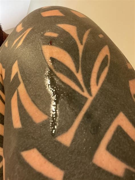 injected my test and it s leaking out r testosterone