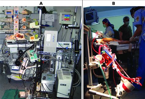 Dos Pacientes Del Programa Ecmo Neonatal Pediátrico Del Hospital