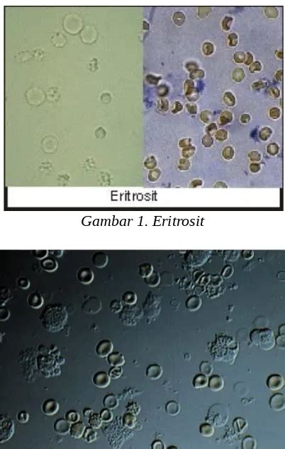 Detail Gambar Eritrosit Pada Urine Koleksi Nomer 4