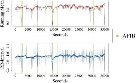 Figure 7 From Atrial Fibrillation Detection Using Rr Intervals For Application In