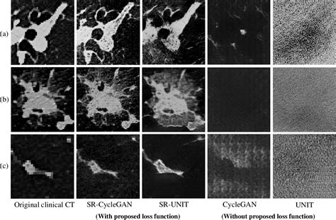Multi Modality Super Resolution Loss For Gan Based Super Resolution Of