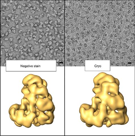 Figure 4 From Sample Preparation Of Biological Macromolecular Assemblies For The Determination