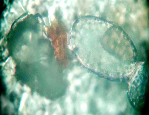 Evaluation Of The Efficiency Of Some Antagonistic Trichoderma Spp In