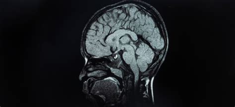 3d Printing Crafts Cerebral Cortex Tissues A Breakthrough For Brain