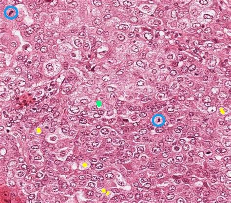 Mitosis Detection Framework Results Download High Quality Scientific Diagram