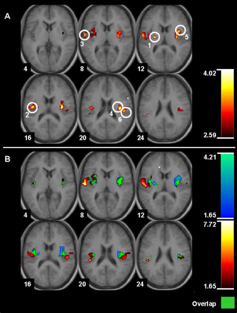A Effect 1 Of Interaction Of Presentation Rate And Semantic Download Scientific Diagram