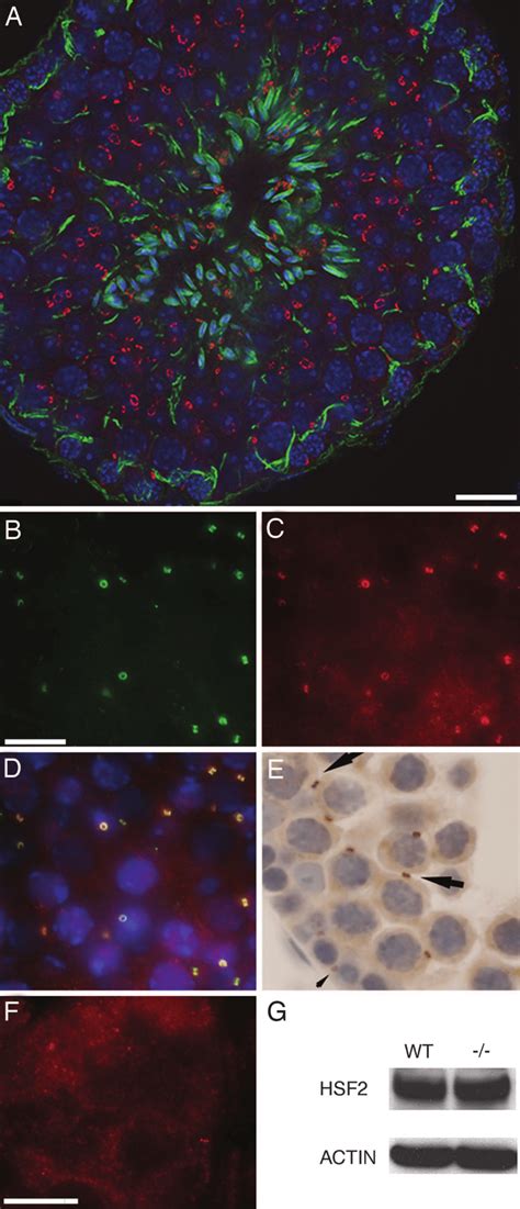 Immunohistological Localization Of Tex14 To Intercellular Bridges A Download Scientific