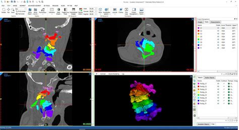 Screenshot From The Segmentation Software The C1 To T1 Vertebrae Were Download Scientific