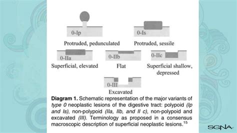 Kudos To You Learning Your Kudo Pit Patterns And Paris Polyp