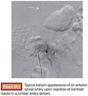 Spine And Bone Trauma Radiology Key