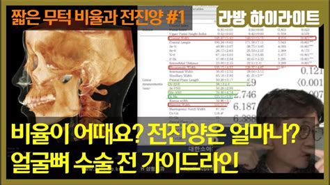 비율이 어때요 전진양은 얼마나 필요해요 얼굴뼈 수술 전 가이드라인 짧은 무턱 비율과 전진양 1 Youtube