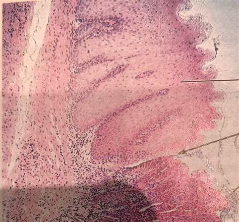 Esophagus Diagram Quizlet