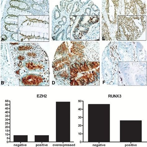 expression of ezh2 and runx3 in normal human colon and in crc specimens