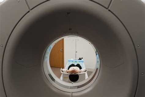 Ct Scans For Lung Cancer Detection One Step Diagnostic