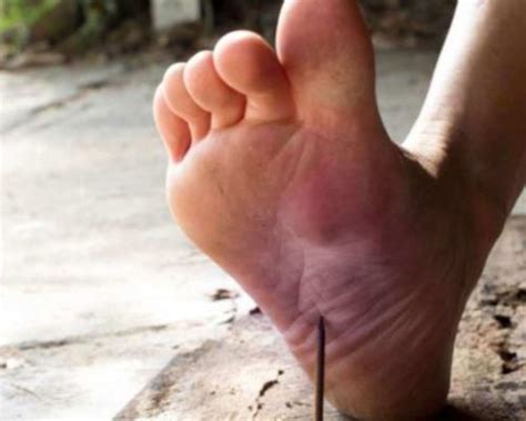 Tetanus Archives Primaya Hospital