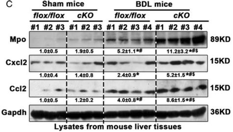 文献解读：runx1基因在胆汁淤积型肝脏炎症中的作用及其机制 生物器材网