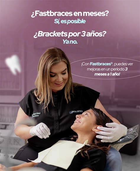 Dra ¿fastbraces En Meses Sí Es Posible ¿brackets Por 3 Años Ya No ¡con Fastbraces Puedes