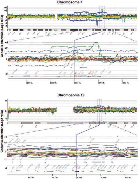 Gene And Chromosome Views Of The Amplified Regions In Array Based Cgh