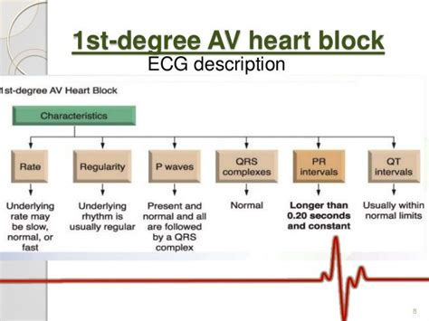Av Block Ecg Analysis