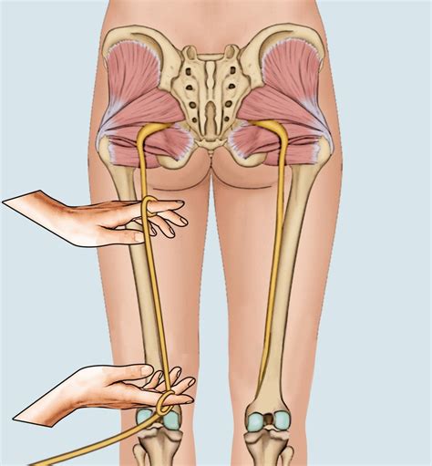 Sciatic Nerve Flossing — Chiroup