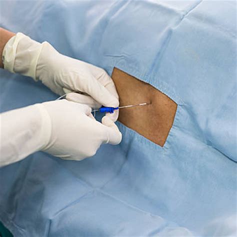 Ultrasound Guided Peripheral Nerve Block Needle Stainless Steel 22g Ultrasound Manufacturers And